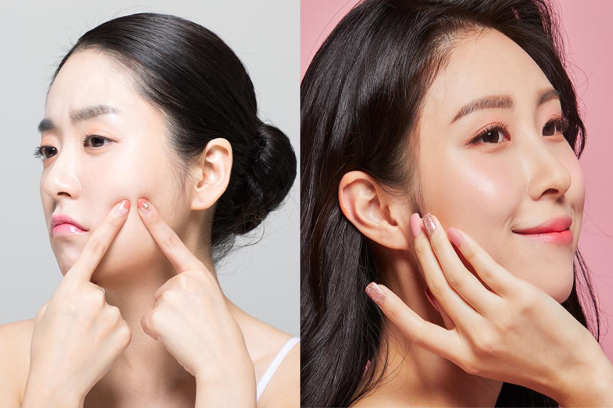 江南 美容皮膚科│ECLAT DE CLINIC - ソウル/韓国 (Creatrip)