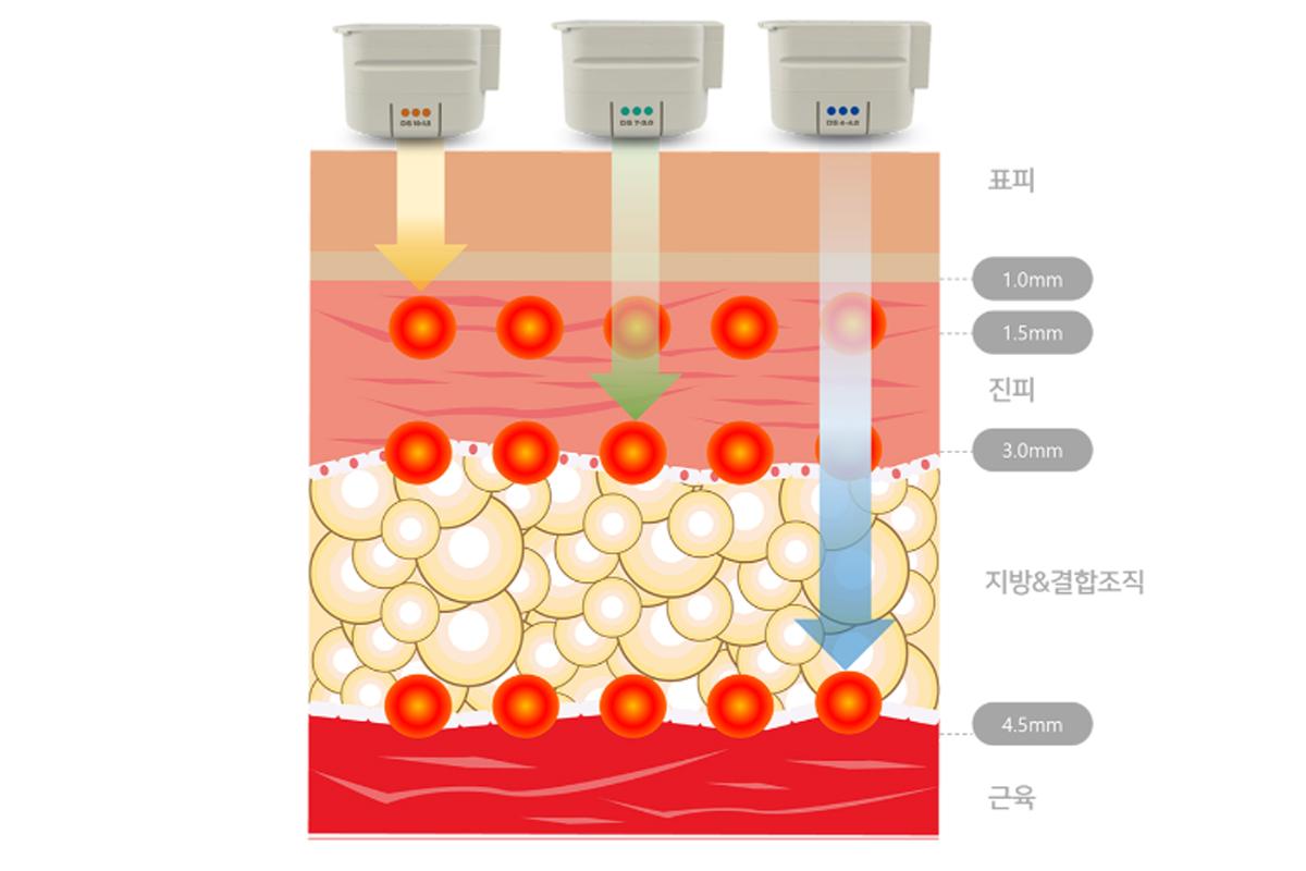 江南 美容皮膚科│ECLAT DE CLINIC - ソウル/韓国 (Creatrip)