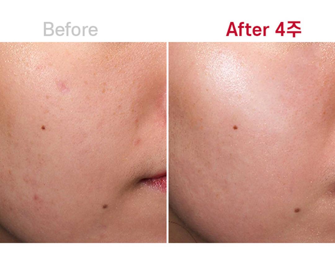 Creatrip: MediCube Clinic Gangnam Branch | Gangnam Skincare Clinic - Seoul/Korea (Korea Travel)