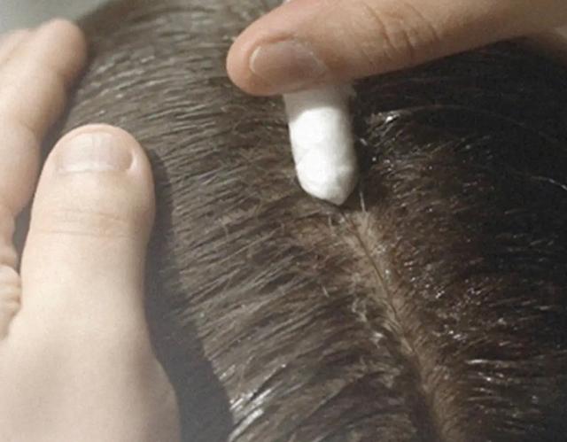 Creatrip: Professional Hair Loss and Scalp CareㅣGreen Scalp Clinique ...